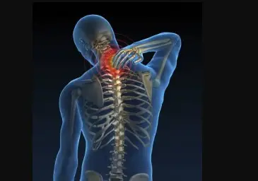 Causes For Severe Neck Pain - Body Pain Tips