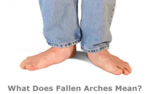 What Does Fallen Arches Mean?