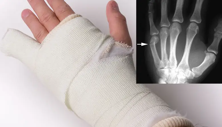 Leave a Reply Cancel reply